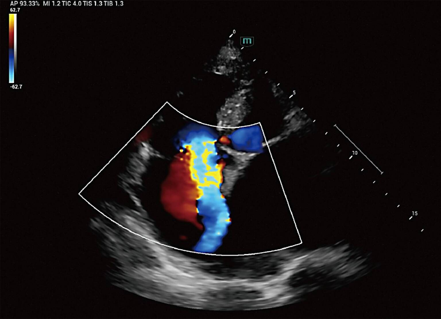 Mindray Resona A20 - Medexpert